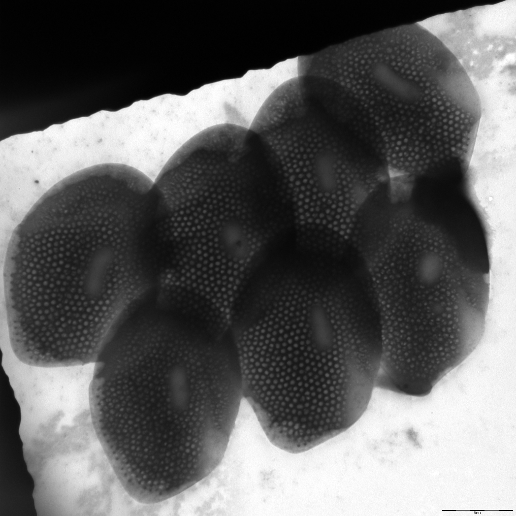 Mallomonas adamas | Silica-scaled chrysophytes of Europe